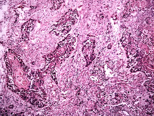 Mold — Stock Photo © bond80 #1026080