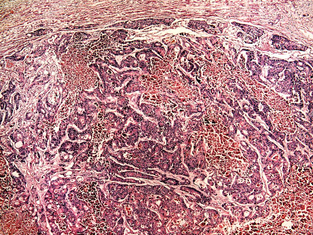 Human Liver Cells Under Microscope