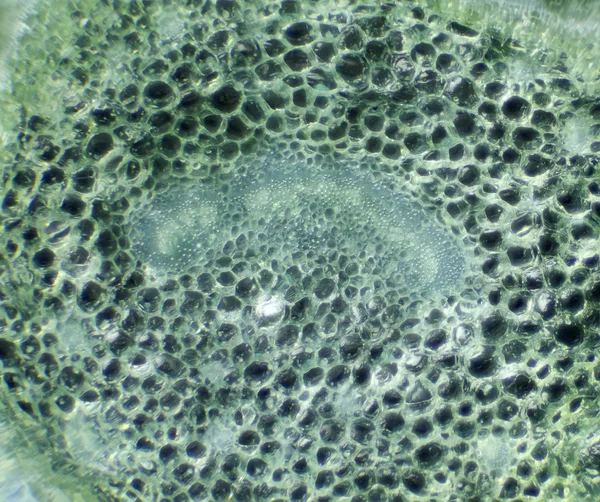 Pictures: red blood cells under a microscope | Chicken red blood cells ...