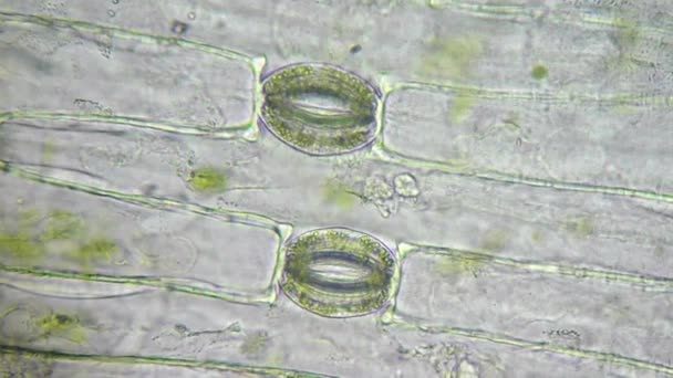 Plant cells with green chloroplasts and stoma under microscope — Stock ...