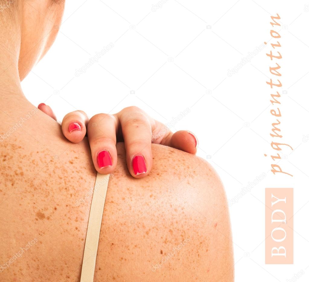 Pigmentation on shoulder Stock Photo by ©nanka-photo 46236269