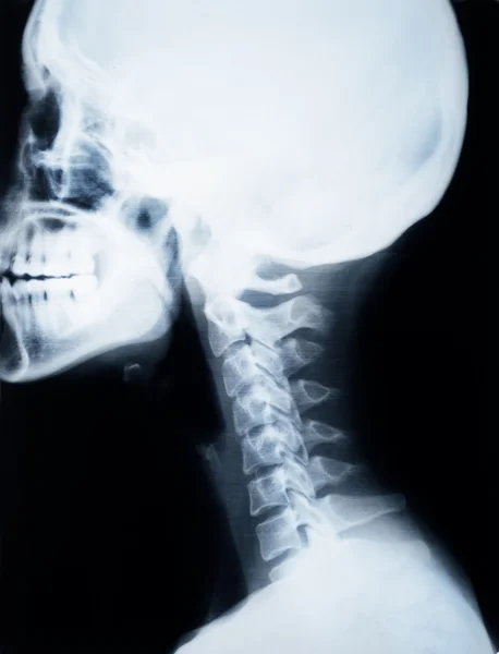 Neck xray Stock Photos, Royalty Free Neck xray Images | Depositphotos®