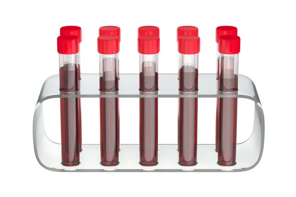 Blood vials rack Stock Photos, Royalty Free Blood vials rack Images ...