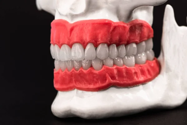 Human jaws with teeth and gums anatomy models — Stock Photo © .shock ...
