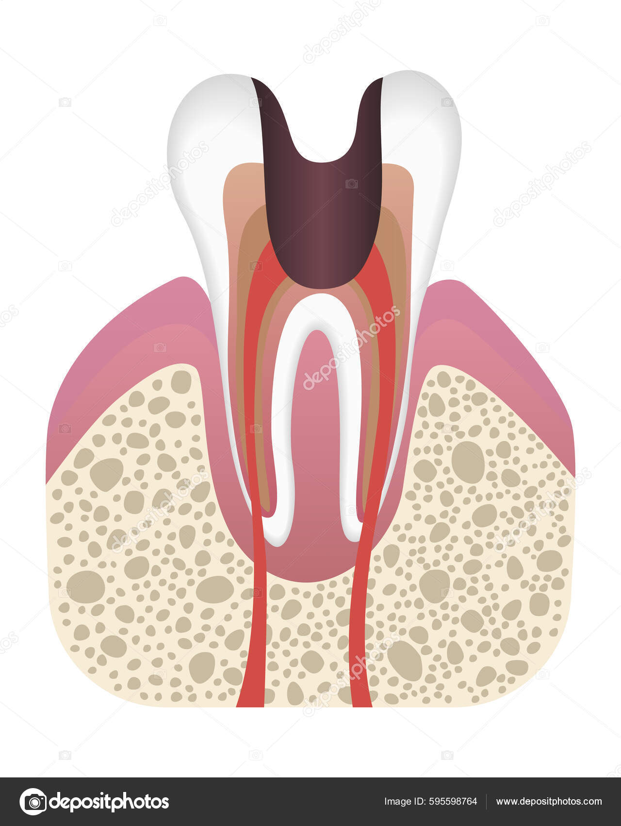 Fase Desarrollo Caries Estructura Los Dientes Estilo Plano Caries ...