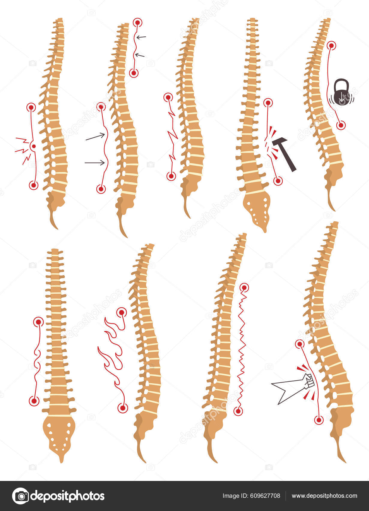 Spinal Deformity Types Symbols Spine Curvatures Unhealthy Backbones ...