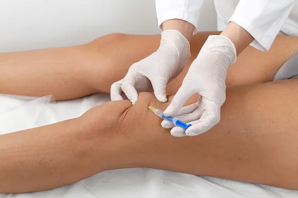 Knee injections Stock Photos, Royalty Free Knee injections Images ...