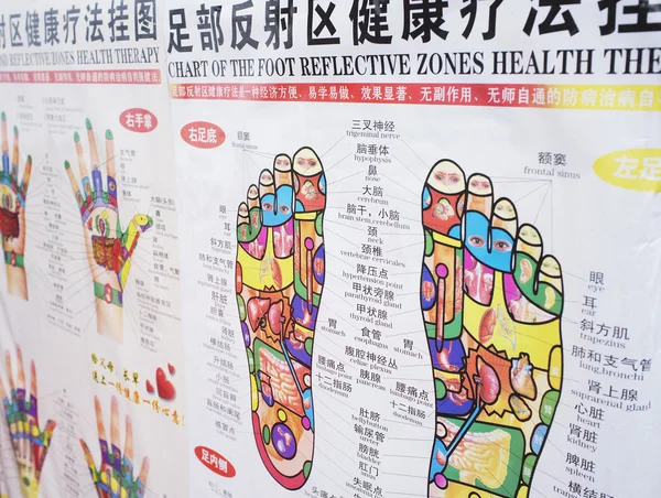 Traditional Chinese Acupuncture – Stock Editorial Photo © Steve_Allen ...