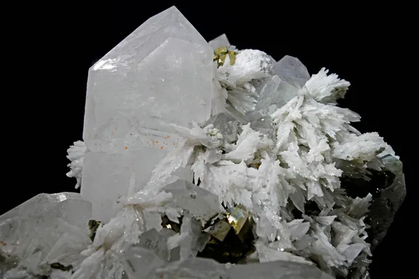 White brain gypsum Stock Photos, Royalty Free White brain gypsum Images ...