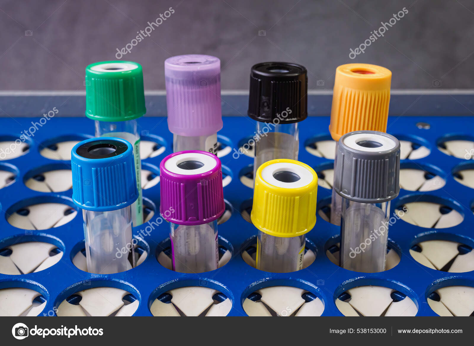 Plastic Test Tubes Caps Collection Samples Blood Sampling Tubes — Stock ...