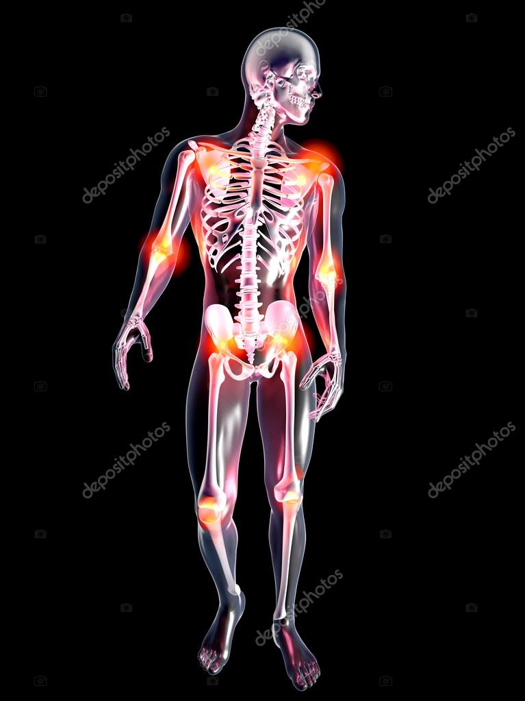 Cruralgie | ppgbbe.intranet.biologia.ufrj.br