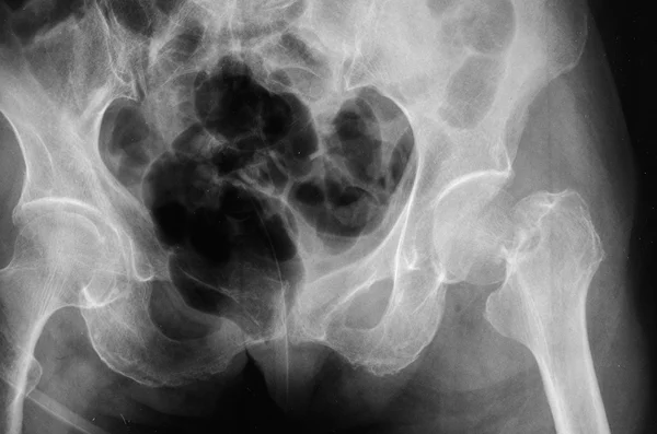 Rentgen pánve — Stock Fotografie © ksena32 #9264900