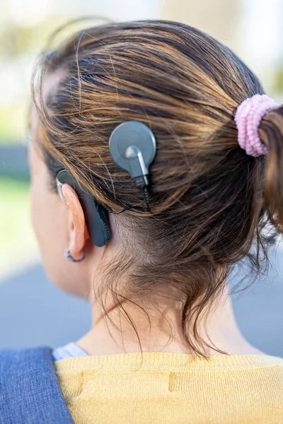 Cochlear implant Stock Photos, Royalty Free Cochlear implant Images ...