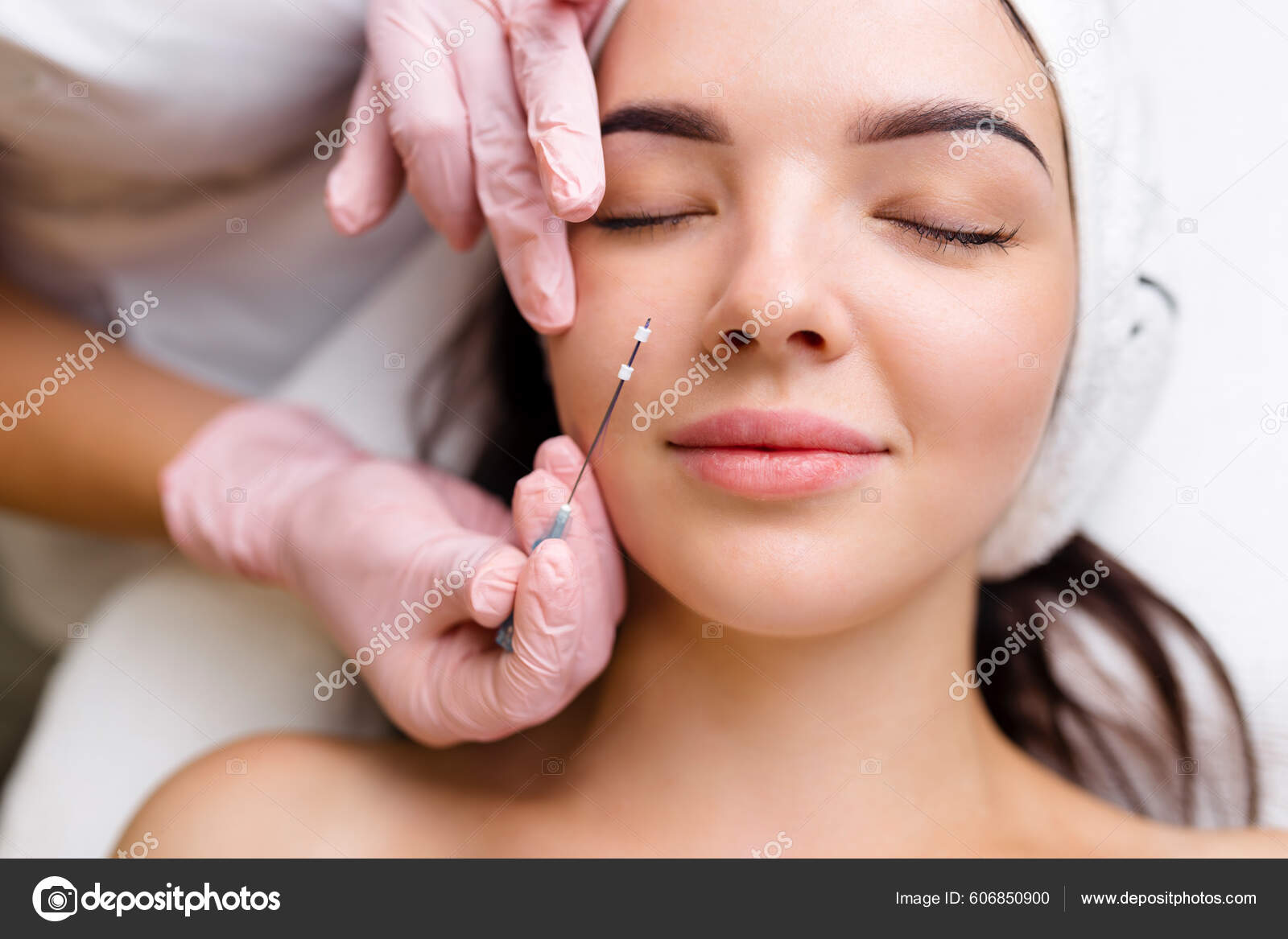 Face Lifting Pdo Suture Operation Innovative Technique New Thread Lift ...