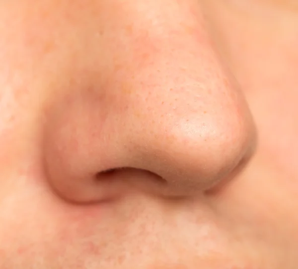 Swollen nose Stock Photos, Royalty Free Swollen nose Images | Depositphotos