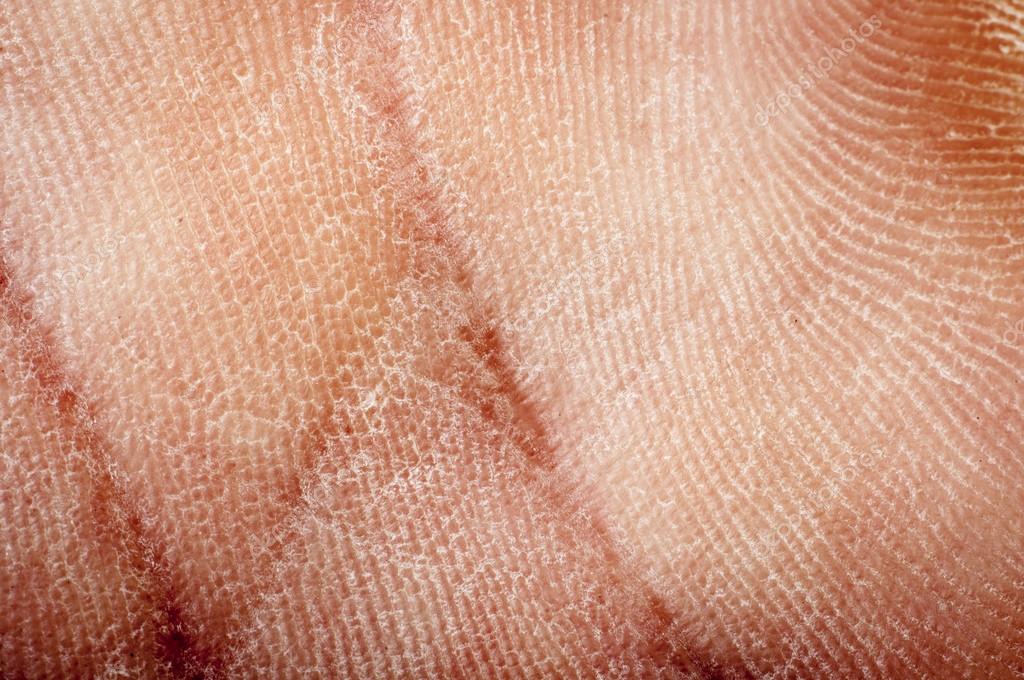 Human dried skin — Stock Photo © masterwilu #17646577