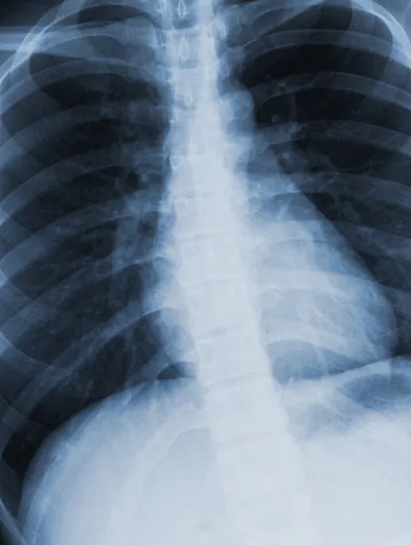 Chest Xray Scan Background Stock Photo by ©YAYImages 263423646