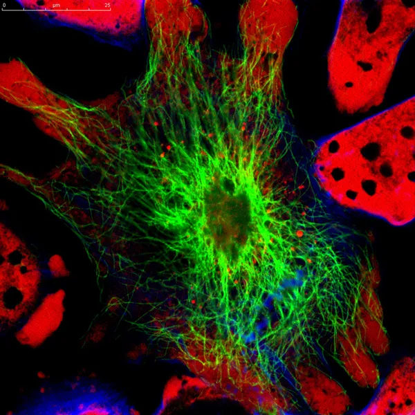 Fibroblasts (skin cells) labeled with fluorescent dyes - Stock Image ...
