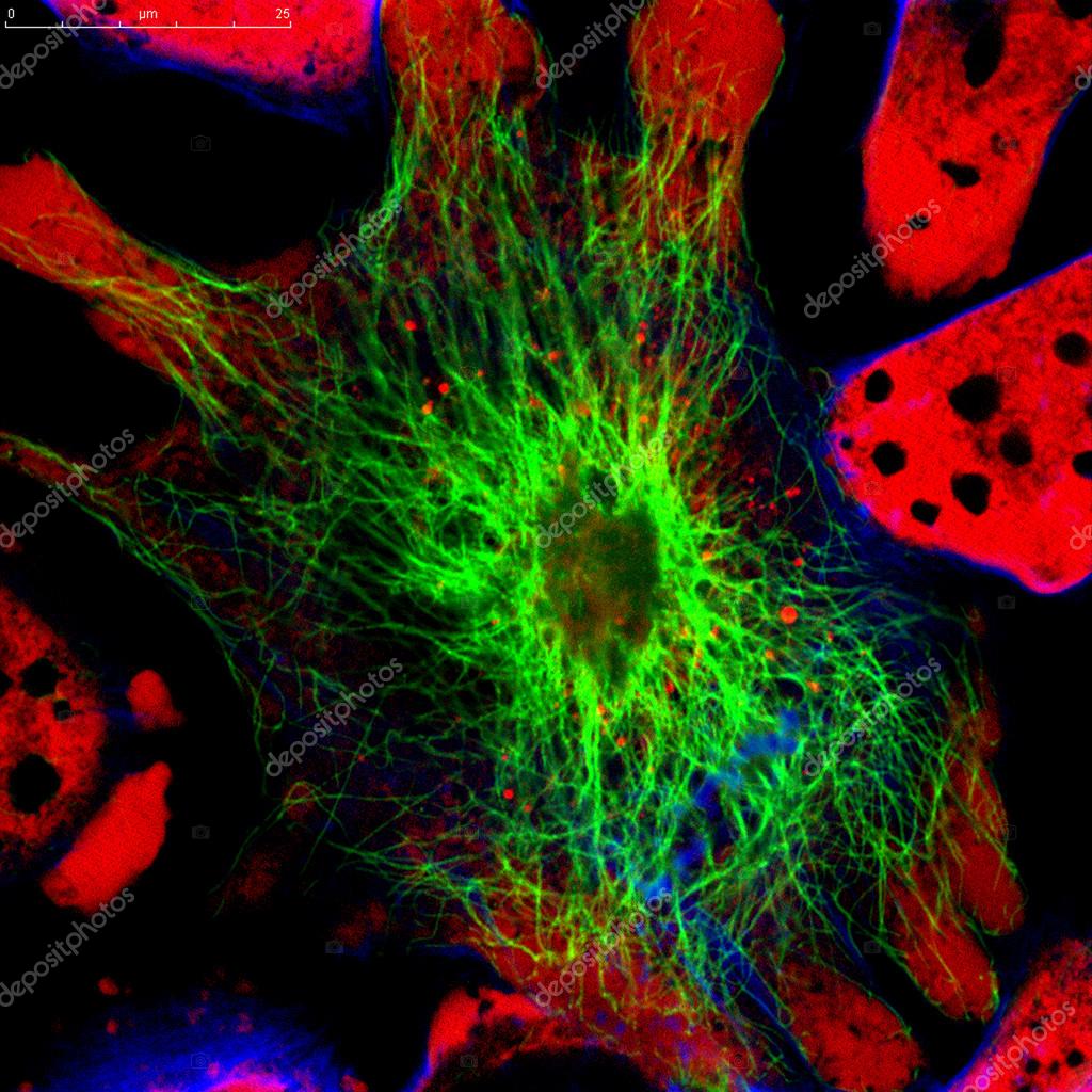 Fibroblastos (células de la piel) etiquetados con colorantes ...