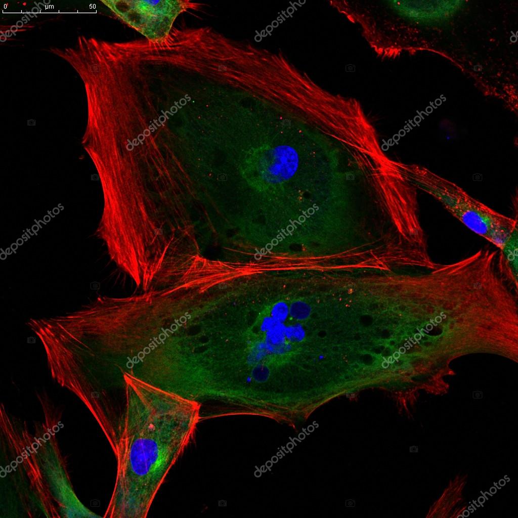 Fibroblastos (células de la piel) etiquetados con colorantes ...