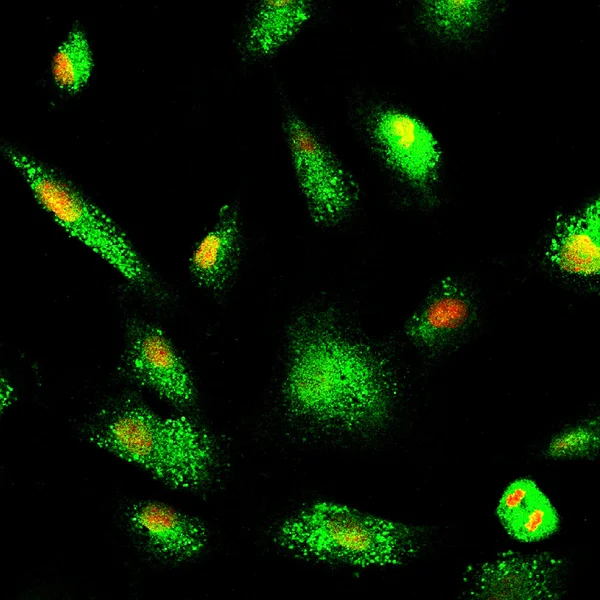 Fibroblasts (skin cells) labeled with fluorescent dyes — Stock Photo ...