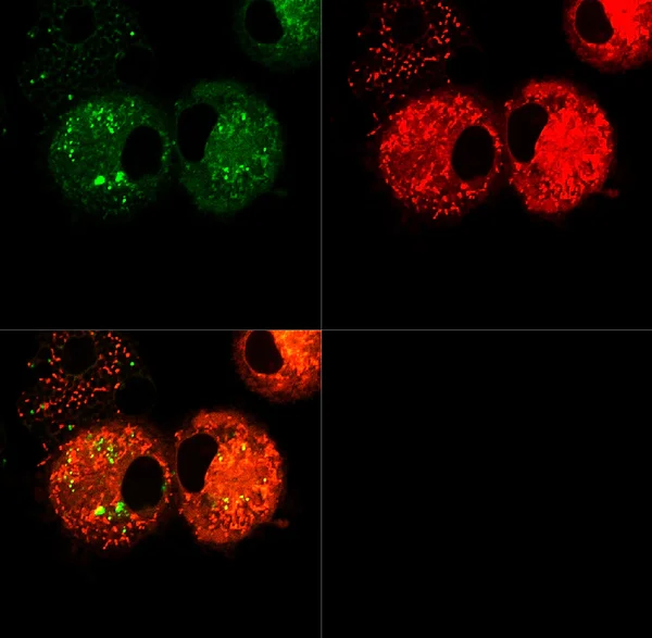 Blood cells labeled with fluorescent dyes — Stock Photo © vshivkova ...