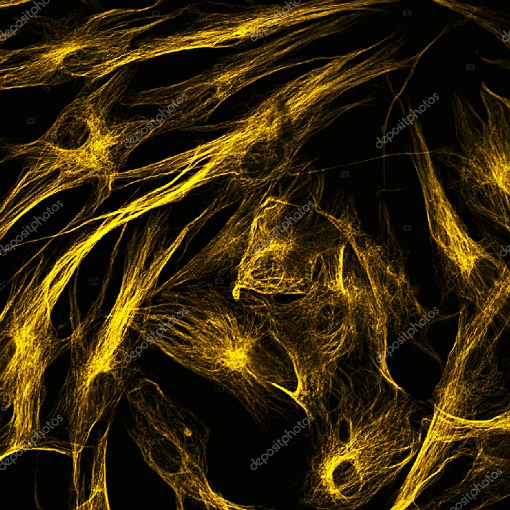 Fibroblasts (skin cells) labeled with fluorescent dyes — Stock Photo ... Fibroblasts (skin cells) labeled with fluorescent dyes — Stock Photo ...