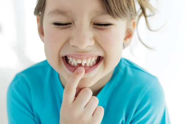 The little girl lost a tooth. Loss of the first tooth in a child ...