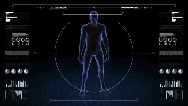 4,744 Pathology Videos, Royalty-free Stock Pathology Footage ...