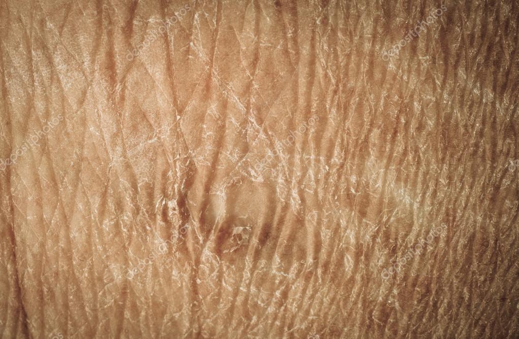 Old Skin Texture