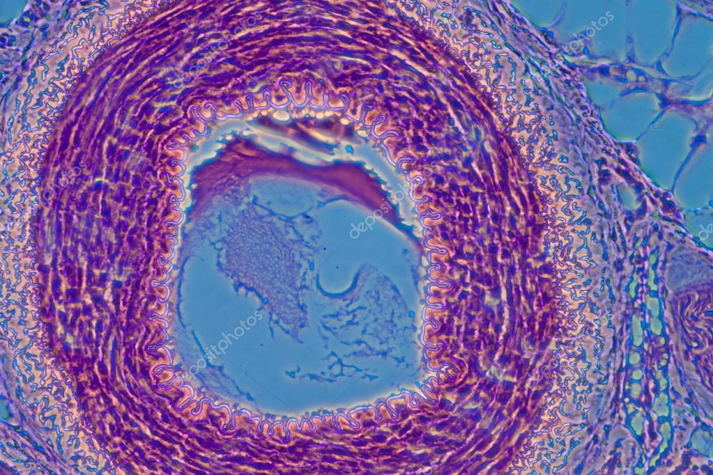 Micrograph of blood vessel, artery and vein — Stock Photo © panxunbin ...