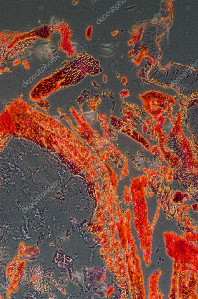 Micrograph of insects body cross section, moth caterpillar — Stock ...