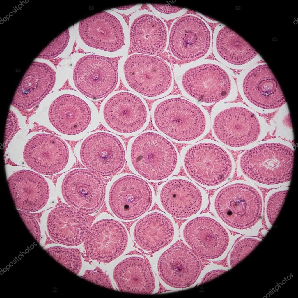 Microscopic section of Testis T.S tissue — Stock Photo © panxunbin ...