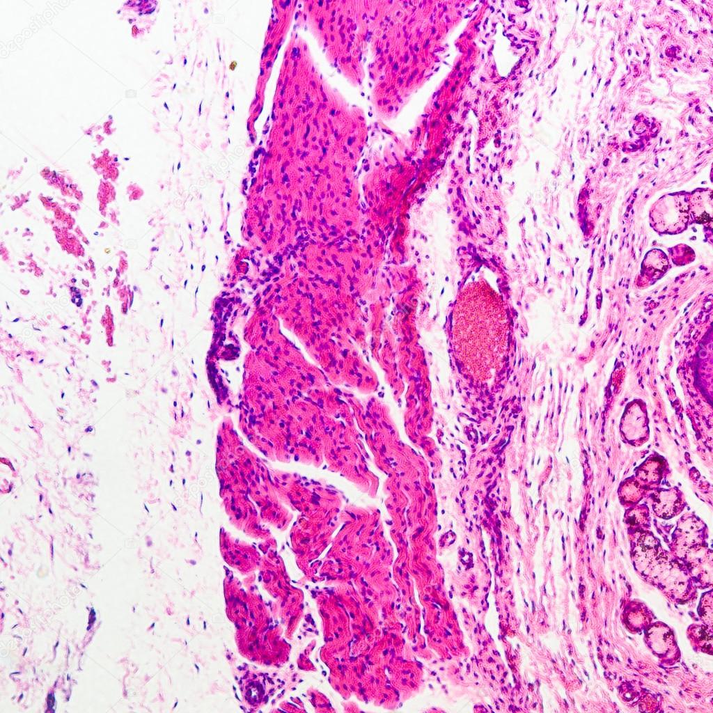 Stratified squamous epithelium Stock Photo by ©panxunbin 17973957