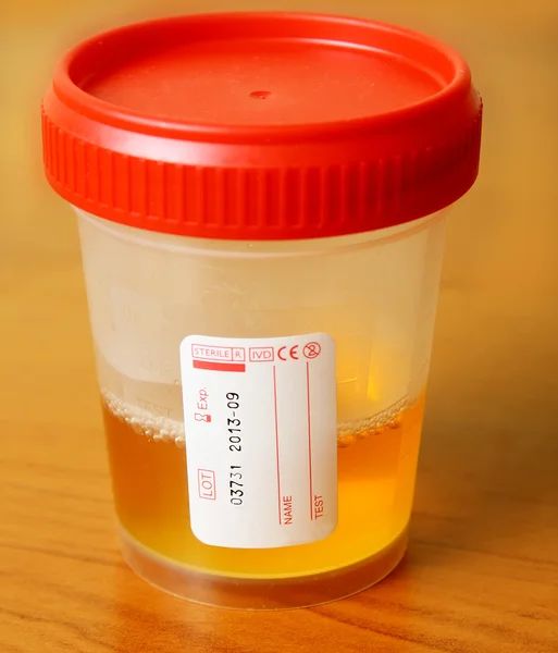 Urine test specimen — Stock Photo © stockarch #5230149