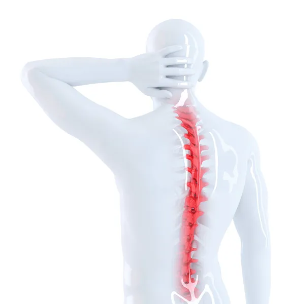 Spinal injury Stock Photos, Royalty Free Spinal injury Images ...