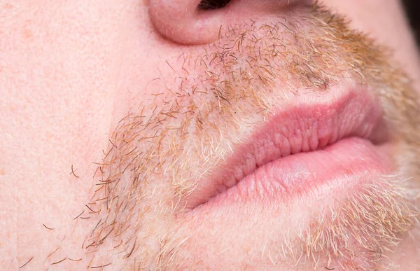 Male acne Stock Photos, Royalty Free Male acne Images | Depositphotos