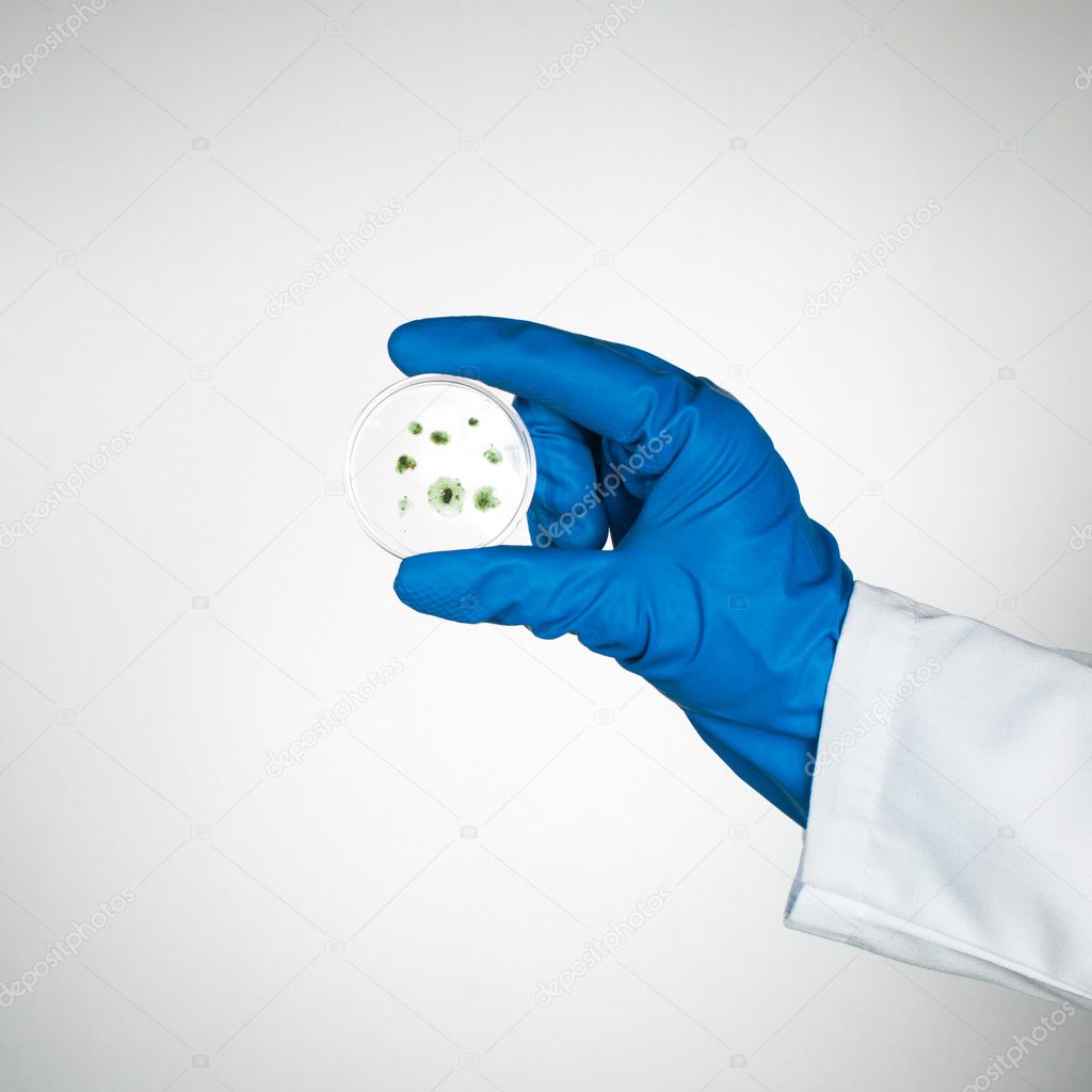 Mold specimen in petri dish — Stock Photo © shotsstudio #27702759