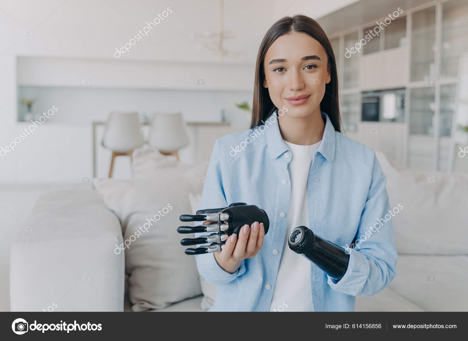 Young Female Prosthetic Arm Showing Her High Tech Bionic Prosthesis ...