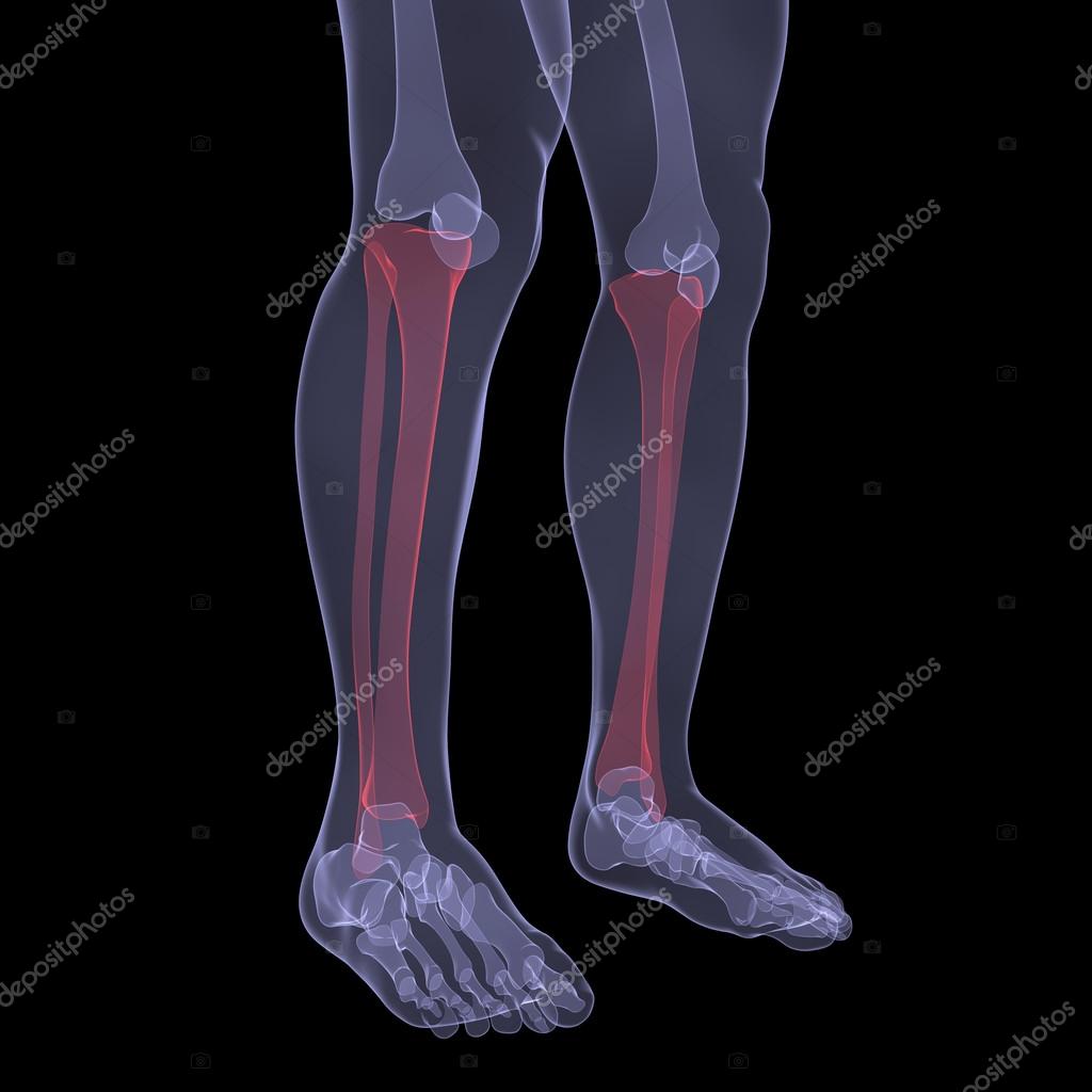 X-ray of human legs Stock Photo by ©cherezoff 23736591