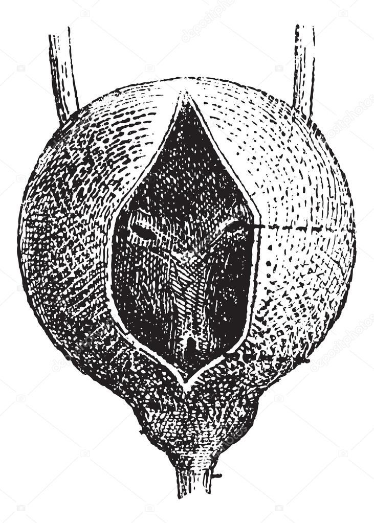 Vejiga Urinaria Humana Grabado Vintage Vector Gráfico Vectorial