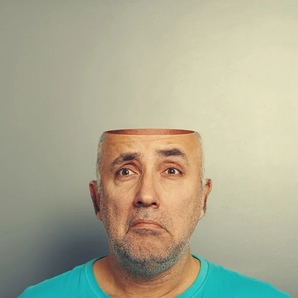 Open head Stock Photos, Royalty Free Open head Images | Depositphotos