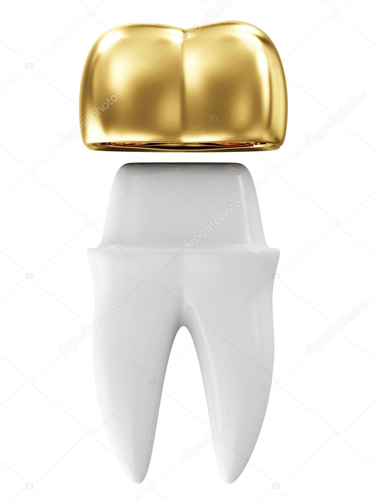 Gold Crown Tooth Drawing