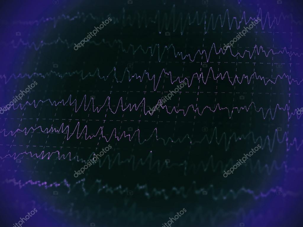 Red graph brain wave EEG Stock Photo by ©dusan964 15339125