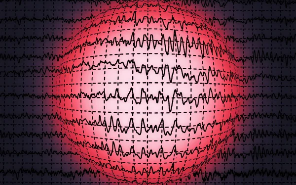 Brain eeg Stock Photos, Royalty Free Brain eeg Images | Depositphotos