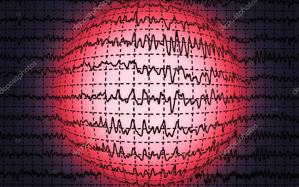 Concept graph brain wave EEG Stock Photo by ©dusan964 32605803