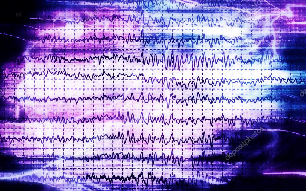 Concept graph brain wave EEG ⬇ Stock Photo, Image by © dusan964 #34765093