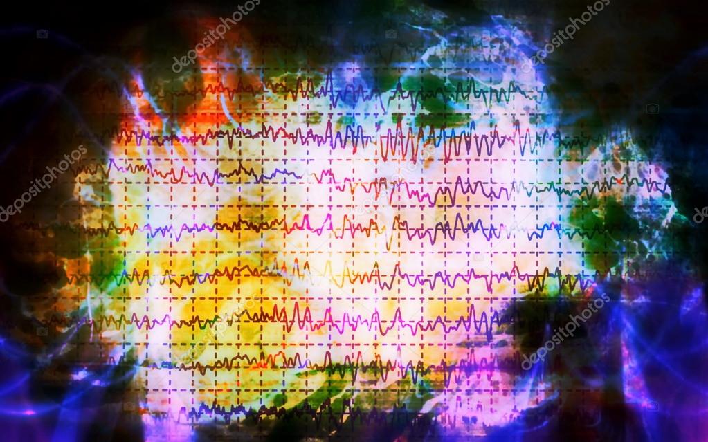 Concept graph brain wave EEG Stock Photo by ©dusan964 34765187