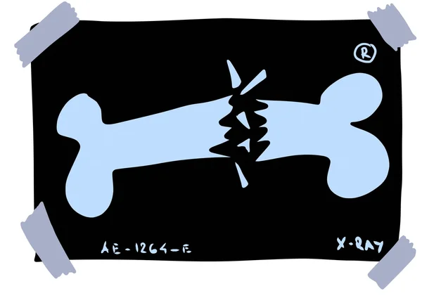X ray funny Stock Photos, Royalty Free X ray funny Images | Depositphotos