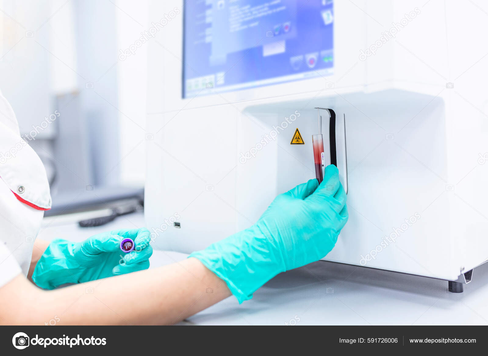 Lab Technician Holding Blood Edta Tube Test Complete Blood Count ...